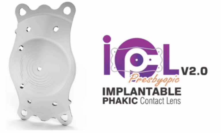 IPCLとは？ICLとの違いは？ - 【医師監修】MyICL